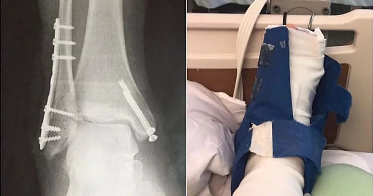 How To Improve Bone Health With Bodyweight Exercise | GMB Fitness